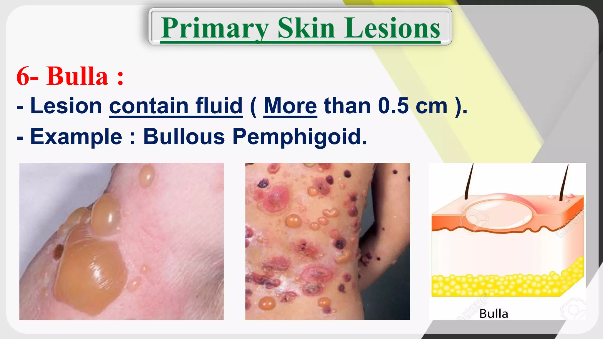 Dermatology (terminology of skin lesions) | PDF