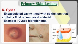 Dermatology (terminology of skin lesions) | PDF