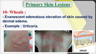 Dermatology (terminology of skin lesions) | PDF