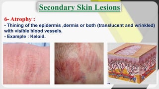 Dermatology (terminology of skin lesions) | PDF