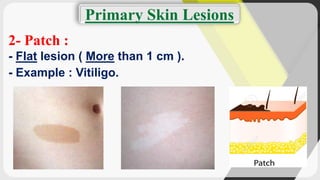 Dermatology (terminology of skin lesions) | PDF