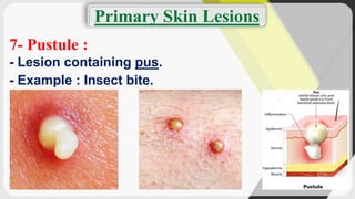 Dermatology (terminology of skin lesions) | PDF
