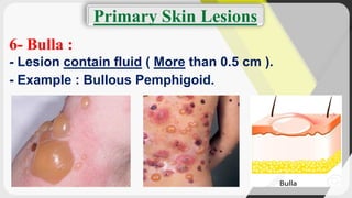 Primary Skin Lesions