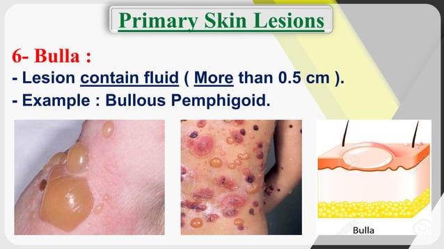 Terminology Of Skin Lesions Dermatology Medbullets