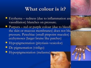 Dermatology without pics | PPT