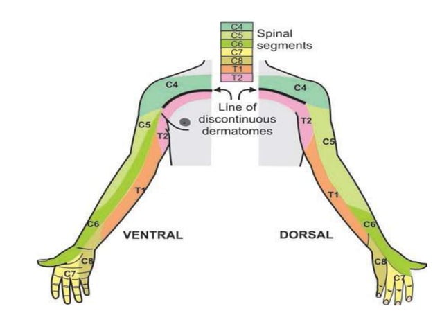 dermatomes and development of limbs copy.pptx | Death, Injury, or ...