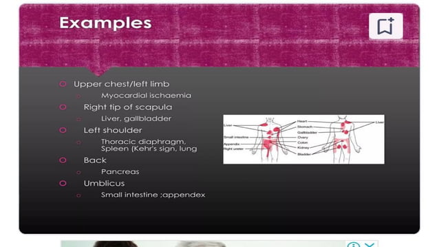 DERMATOMES AND REFERRED PAIN.prentationx | PPT