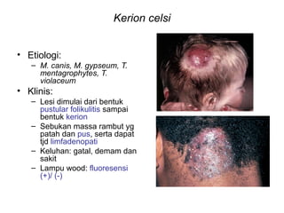 Dermatomikosis | PPT