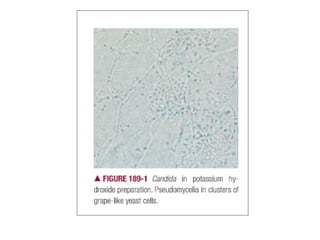 Dermatomikosis | PPT