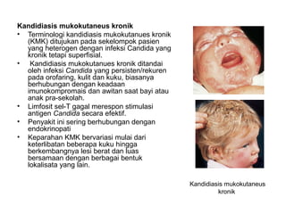 Dermatomikosis | PPT