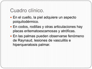 Dermatomiositis | PPTX