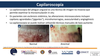 Sesión Académica del CRAIC "Dermatomiositis y esclerodermia" | PDF