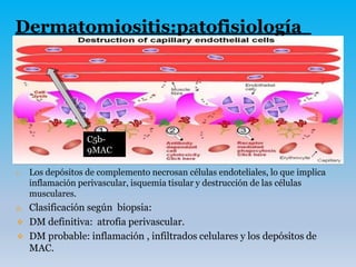 Dermatomiositis.pptx