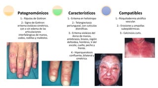 Dermatomiositis en Dermatologia, generalidades | PPTX