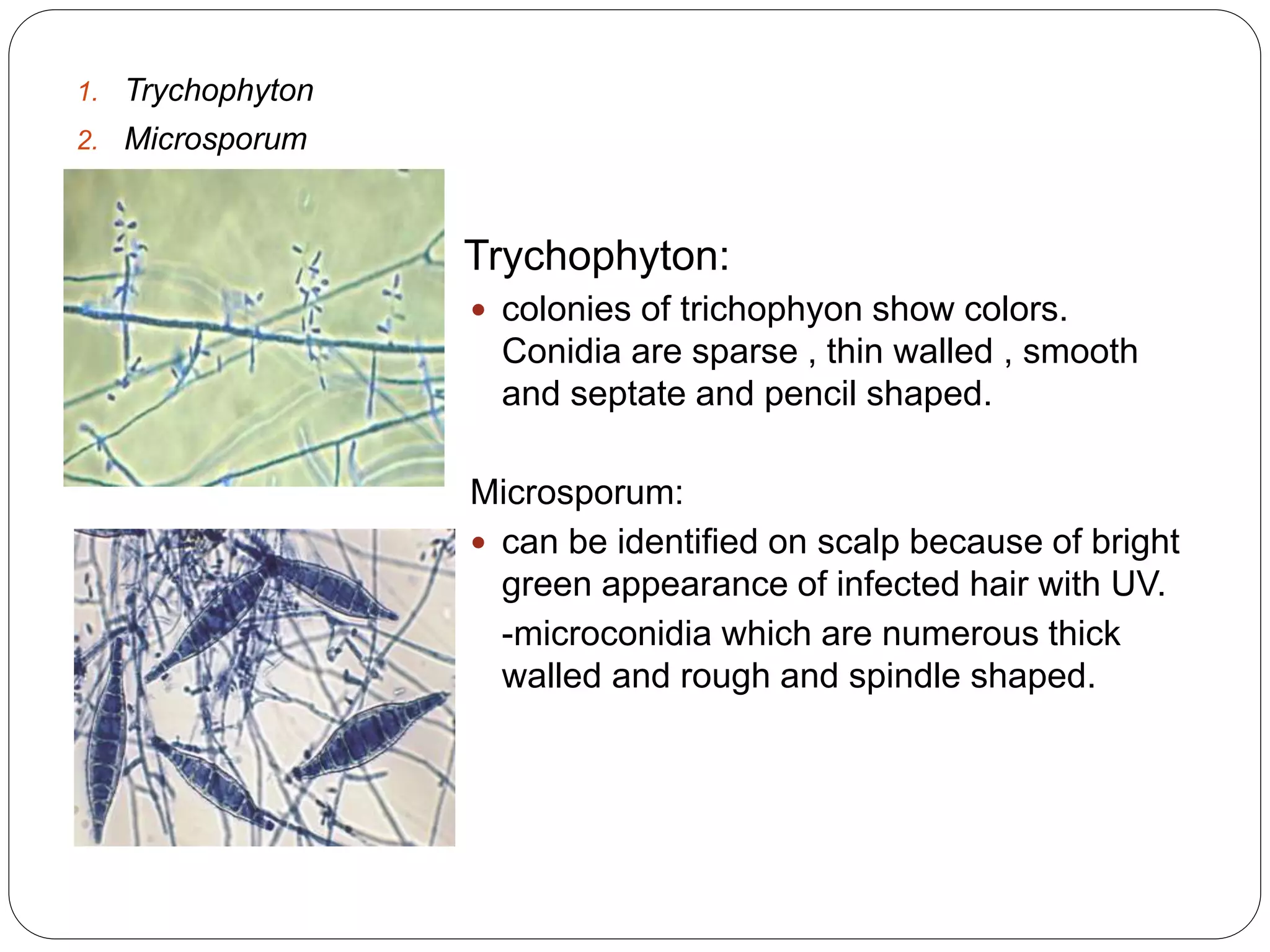 Dermatomycosis | PPTX