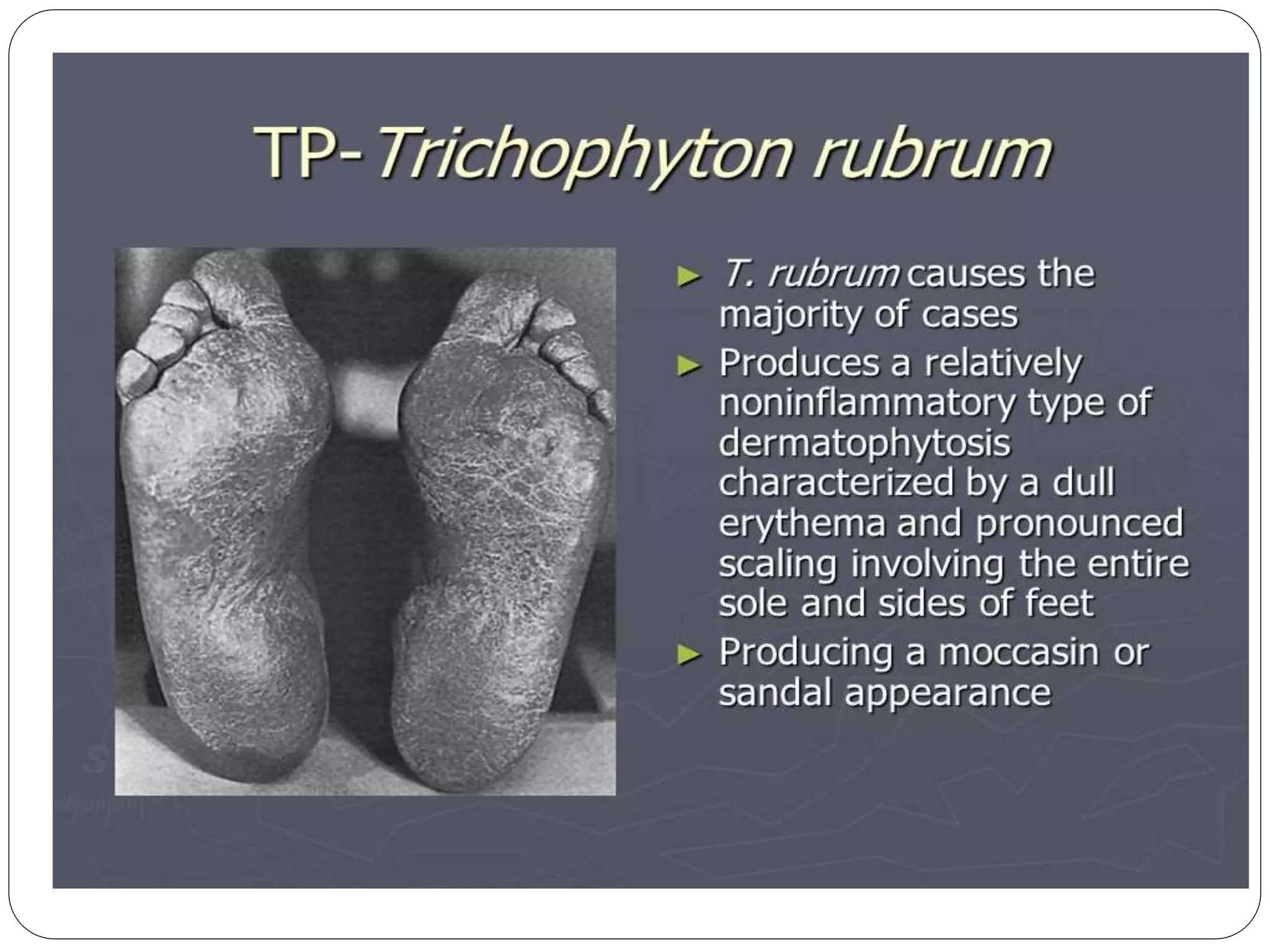 Dermatomycosis | PPTX