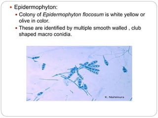 Dermatomycosis | PPTX