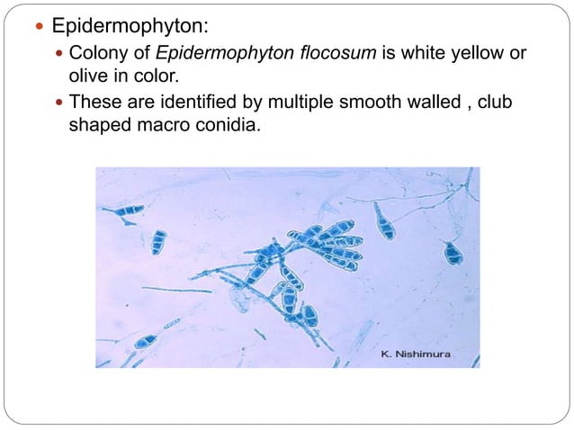 Dermatomycosis | PPTX | Skin and Dermatology | Diseases and Conditions