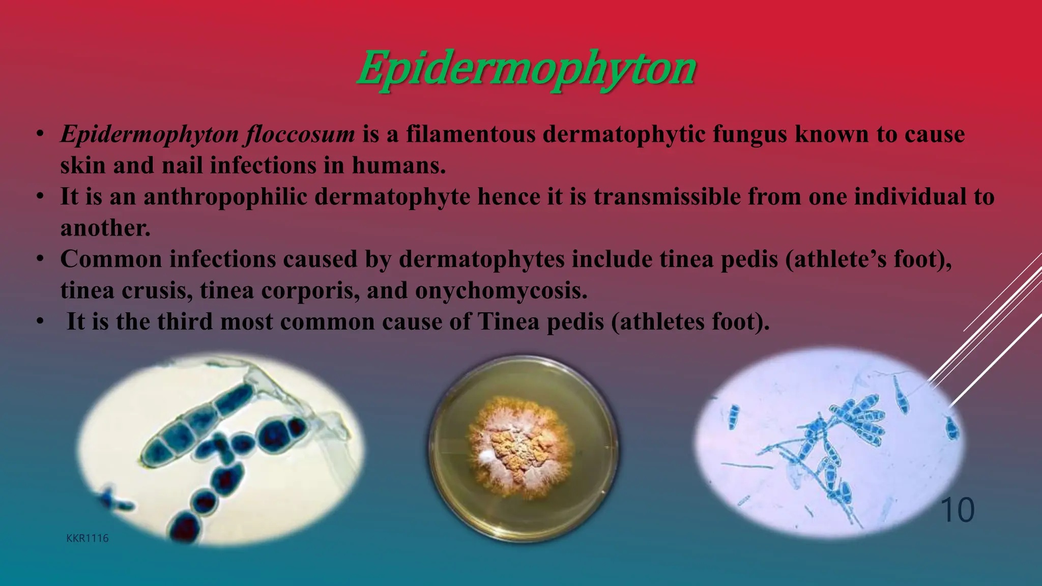 DERMATOMYCOSIS Epidermophyton KKR.pptx
