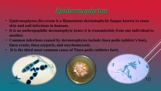 DERMATOMYCOSIS Epidermophyton KKR.pptx