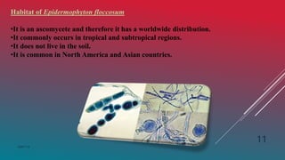 DERMATOMYCOSIS Epidermophyton KKR.pptx | Skin and Dermatology ...