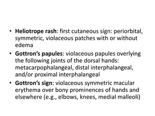 Dermatomyositis | PPTX