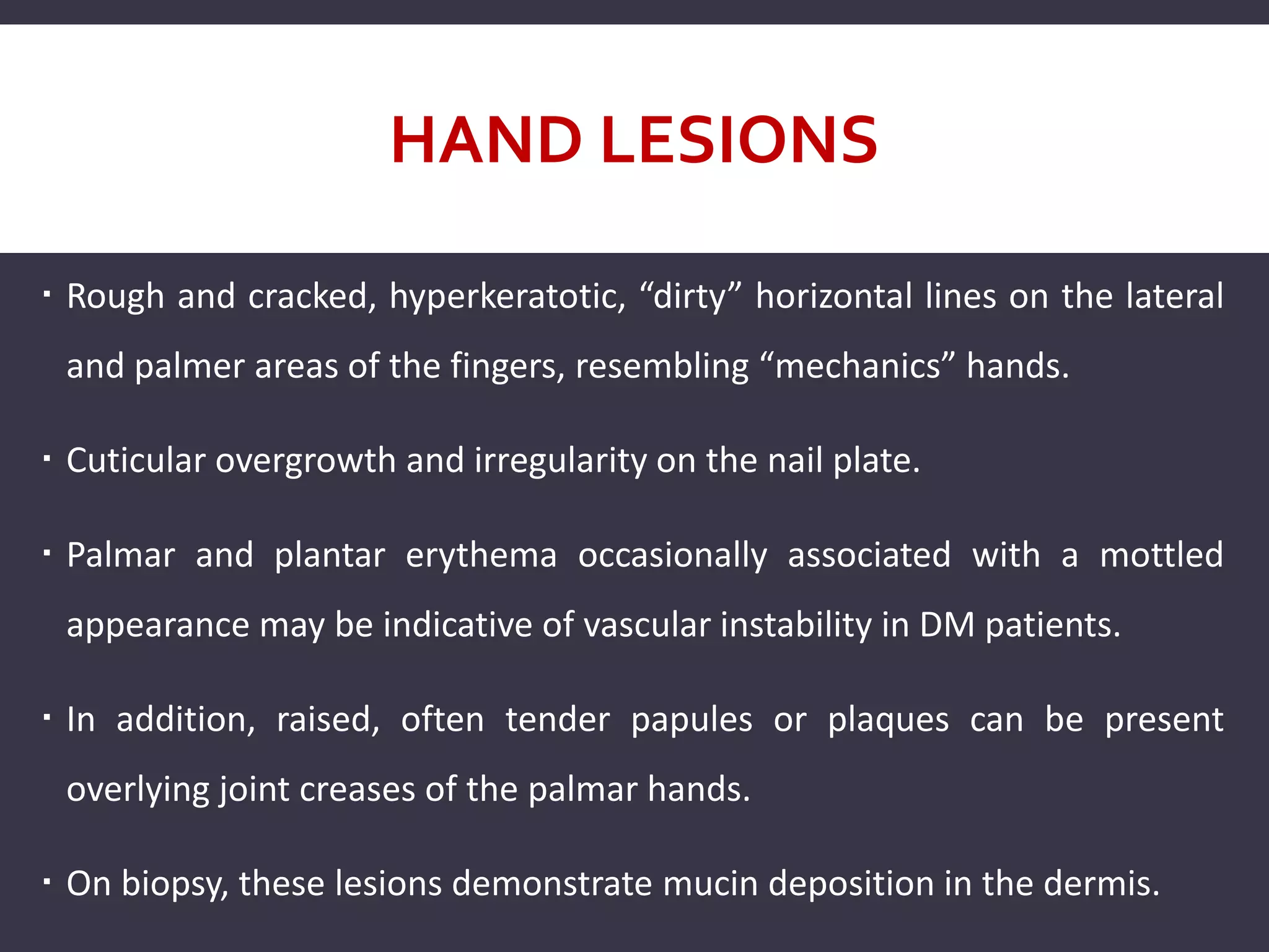 Dermatomyositis | PPTX