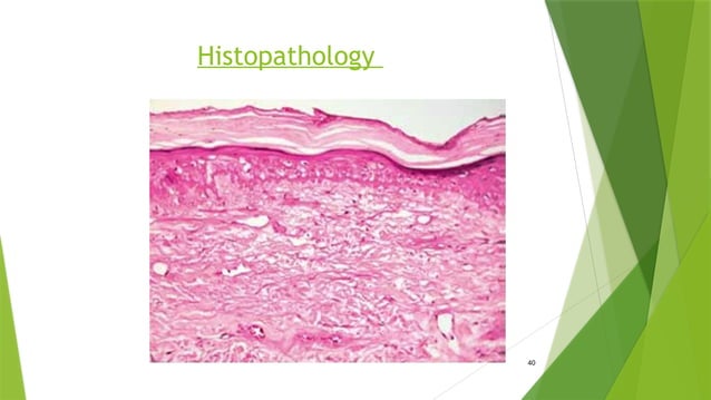 dermatomyositis clinical and diagnosis and management | PPT