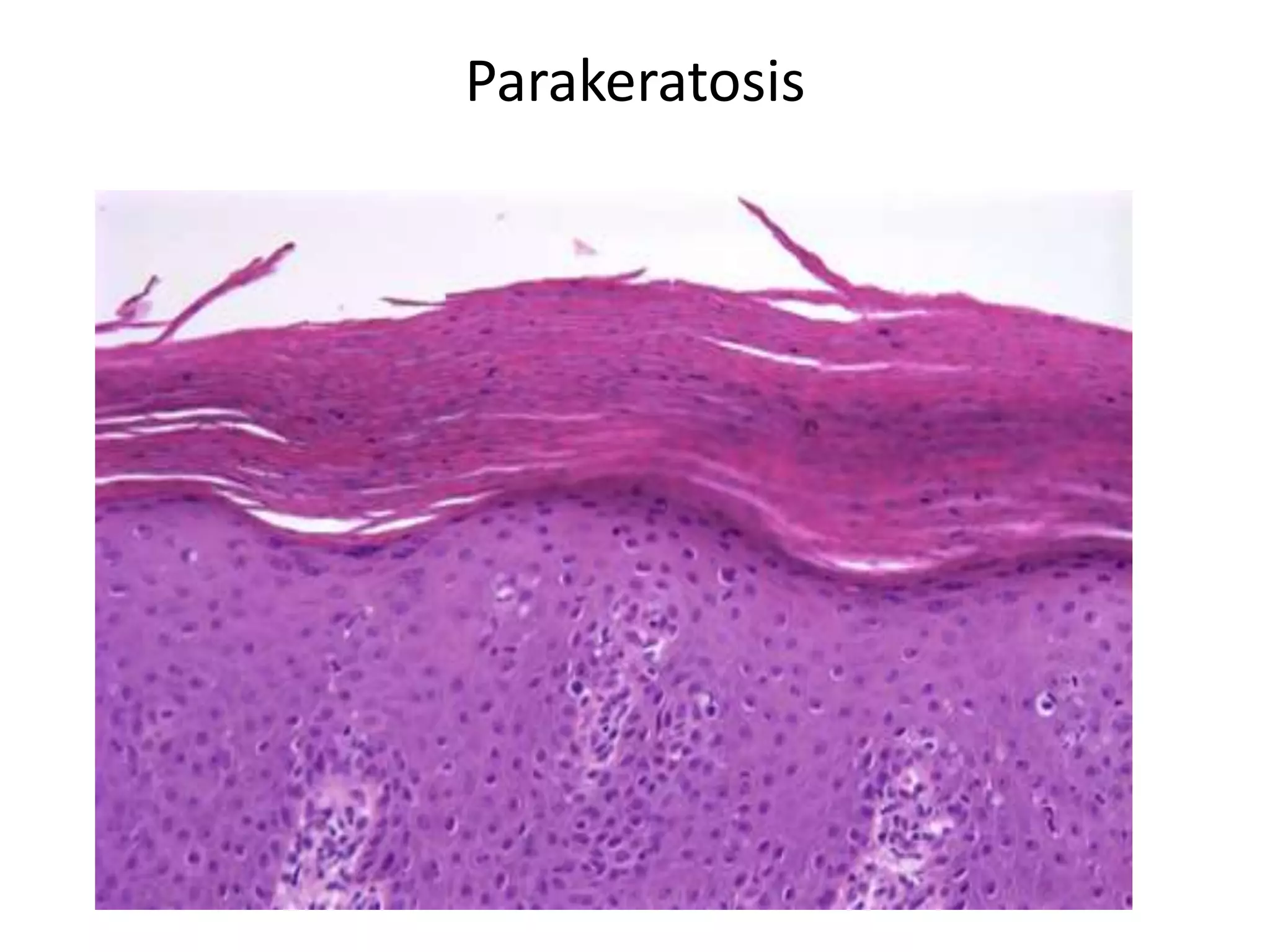 Dermatopathology1 | PPT | Skin and Dermatology | Diseases and Conditions
