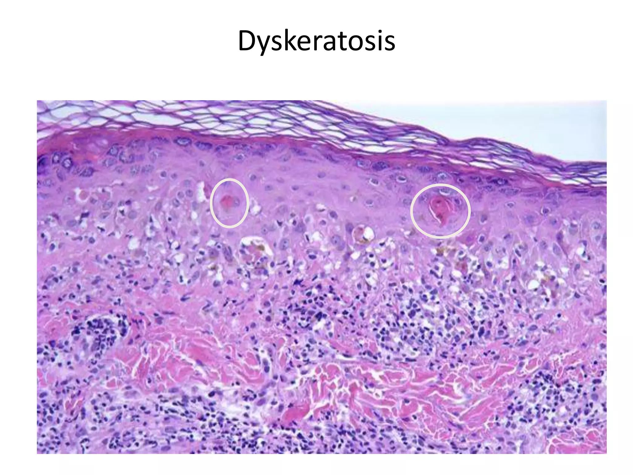 Dermatopathology1 | PPT | Skin and Dermatology | Diseases and Conditions