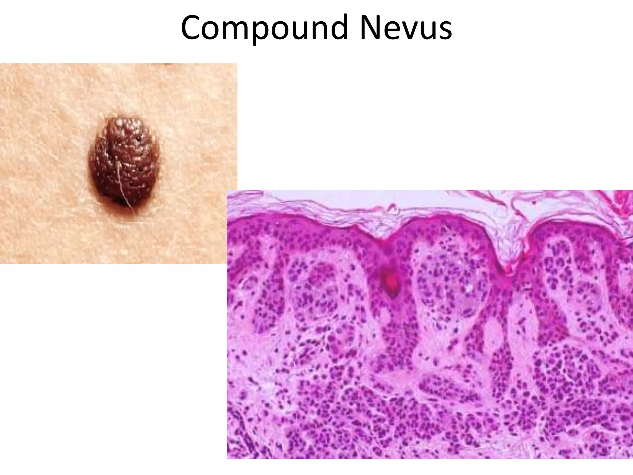 Dermatopathology1 | PPT | Skin and Dermatology | Diseases and Conditions
