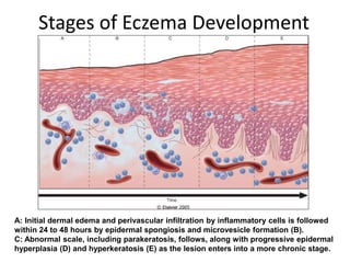 Dermatopathology2 | PPT