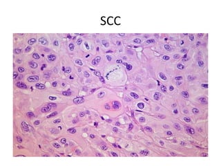 Dermatopathology2 | PPT