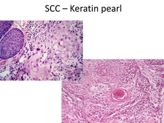 Dermatopathology2 | PPT