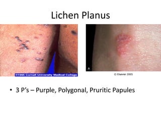 Dermatopathology3 | PPT