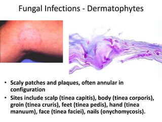 Dermatopathology3 | PPT