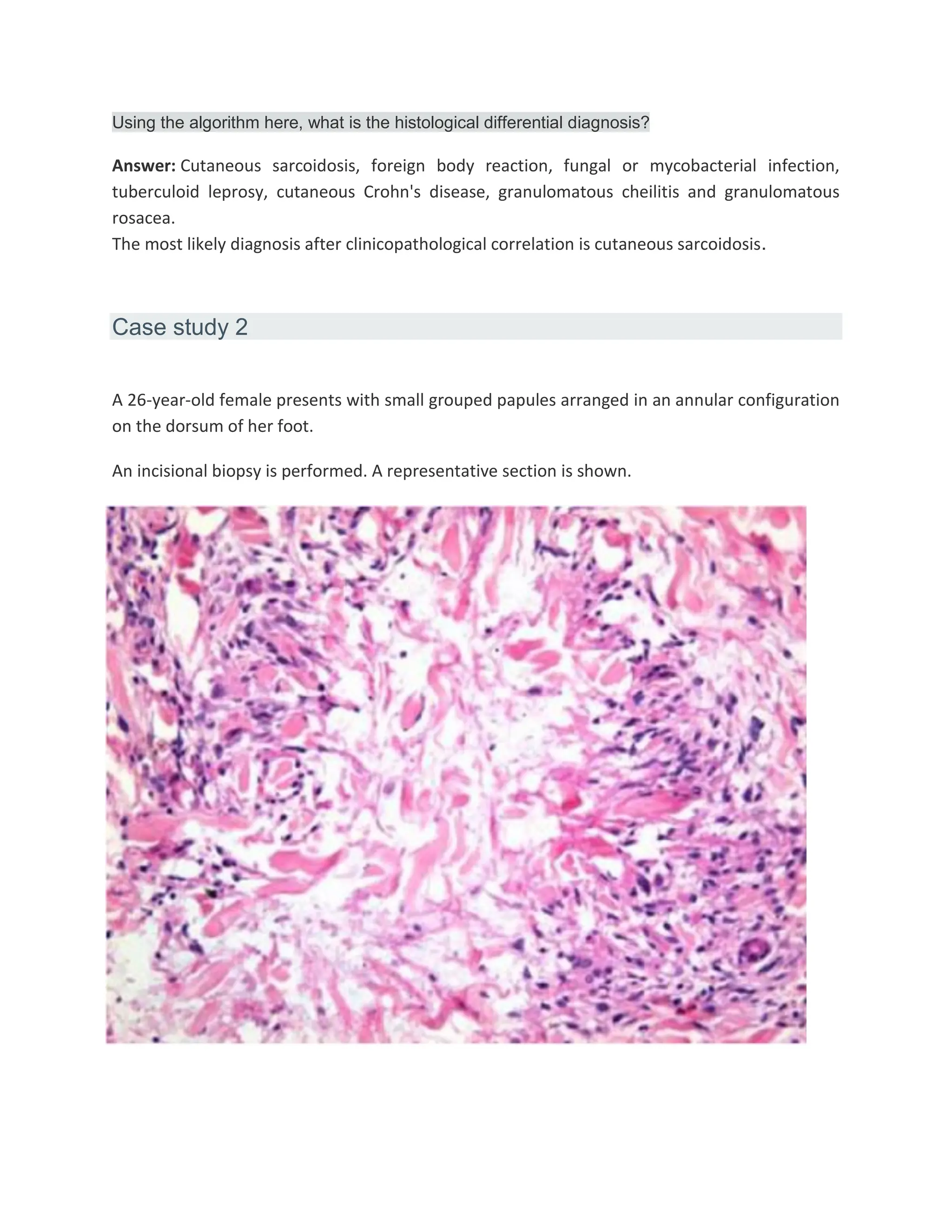 dermatopathology granulomatous inflammation.pdf