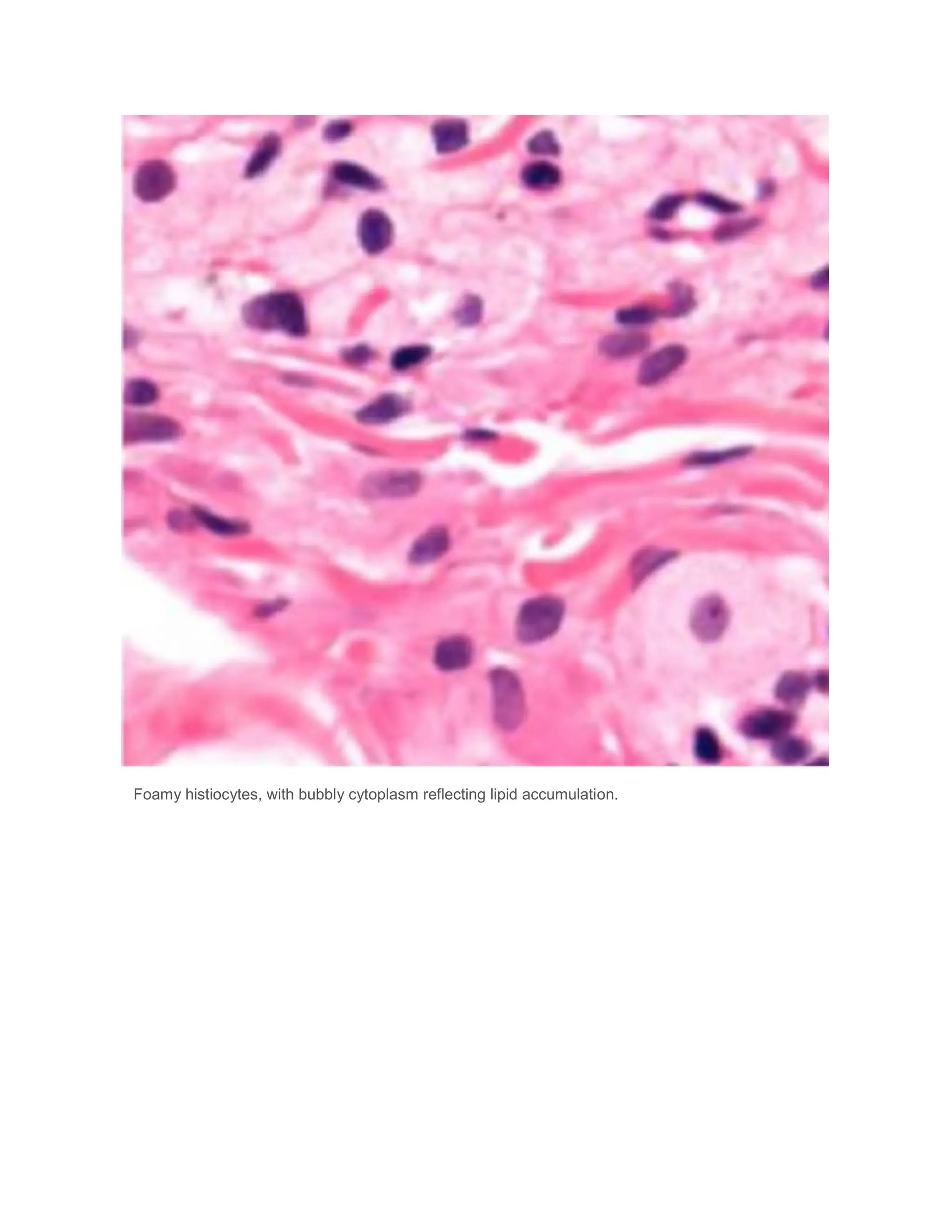 dermatopathology granulomatous inflammation.pdf