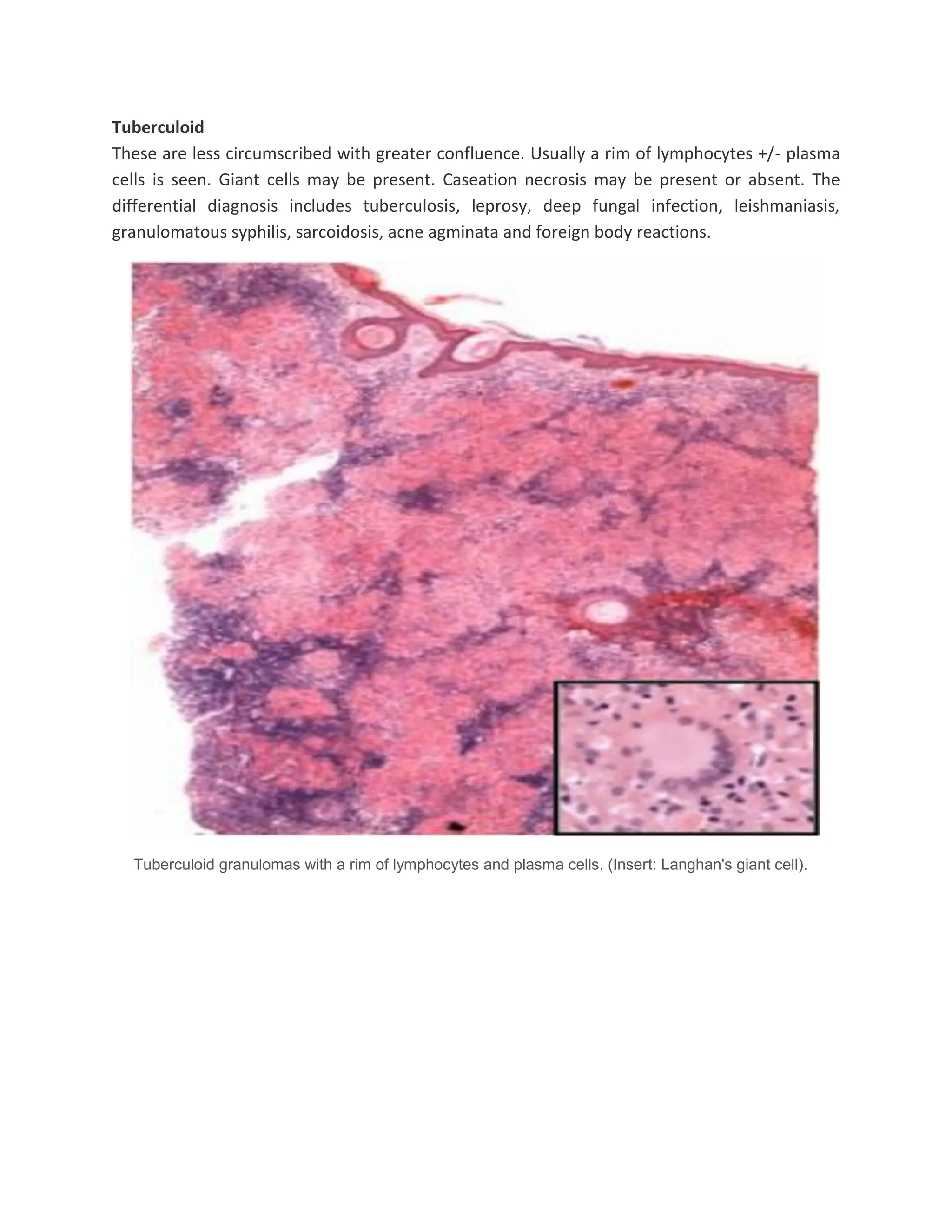 dermatopathology granulomatous inflammation.pdf