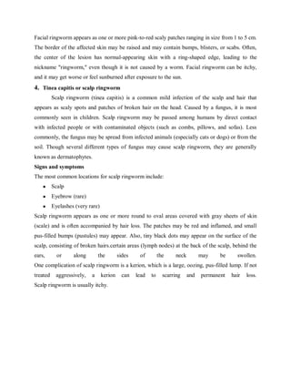 Dermatophyte Candida And Aspergillosis Pdf