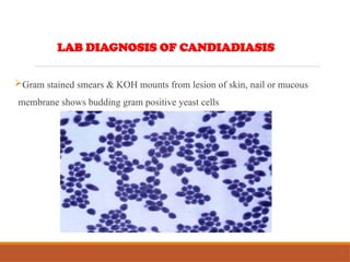 Dermatophyte Candidiasis,.pptx Manoj Mahato | PPTX