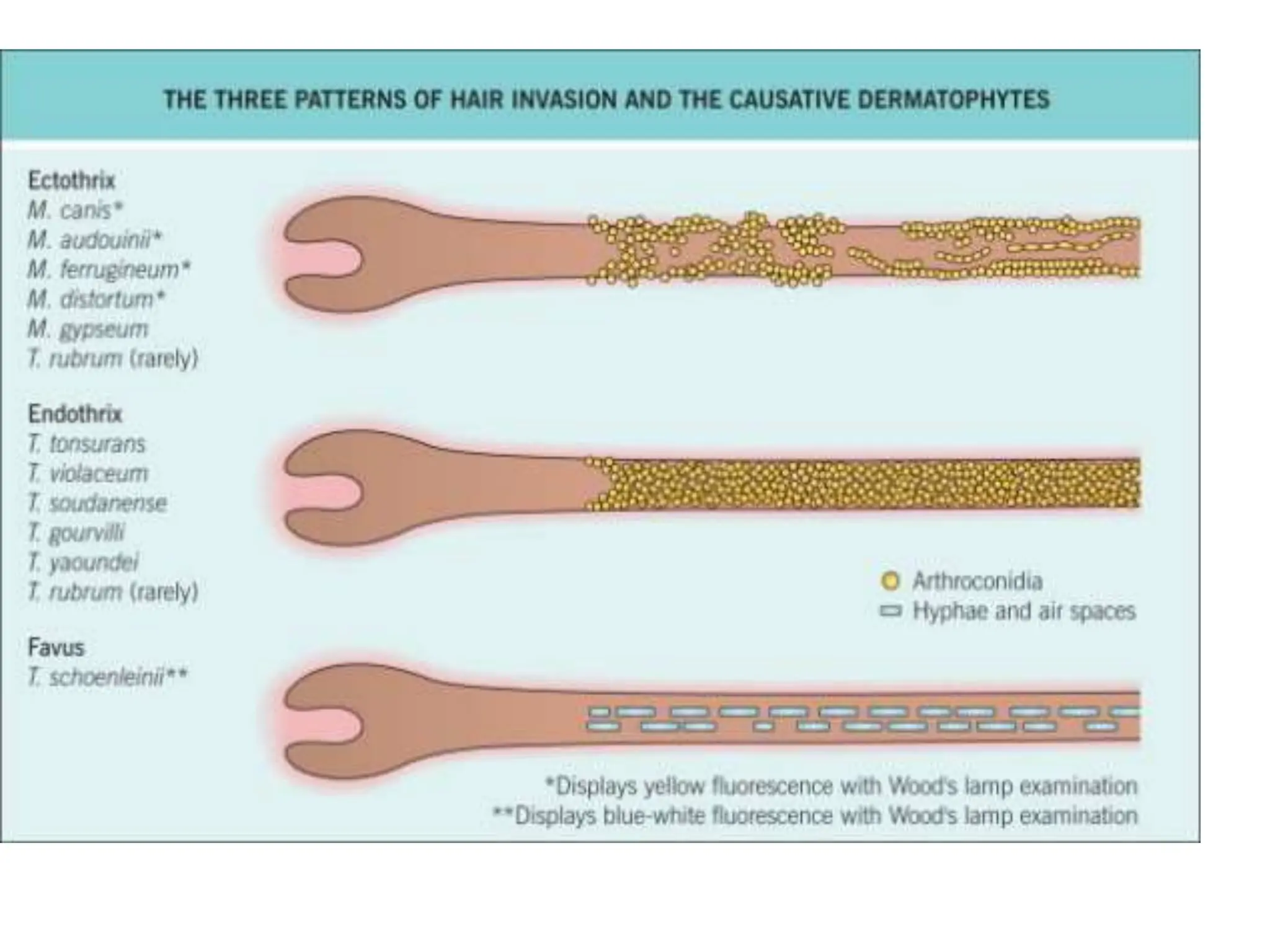 Dermatophyte infection (2).pptx | Skin and Dermatology | Diseases and ...