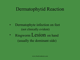 Dermatophytes | PPT