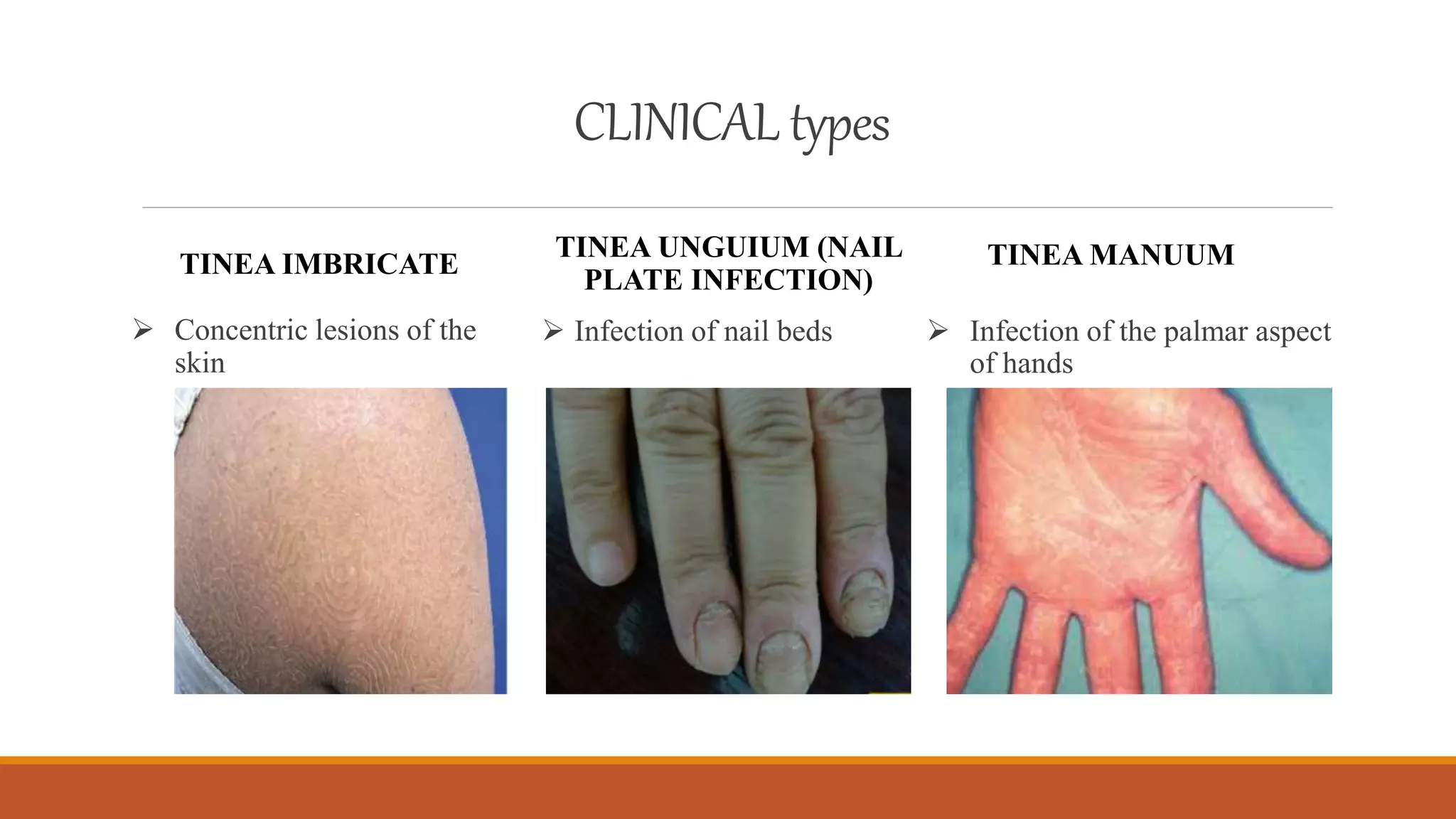 Dermatophytes | PPTX