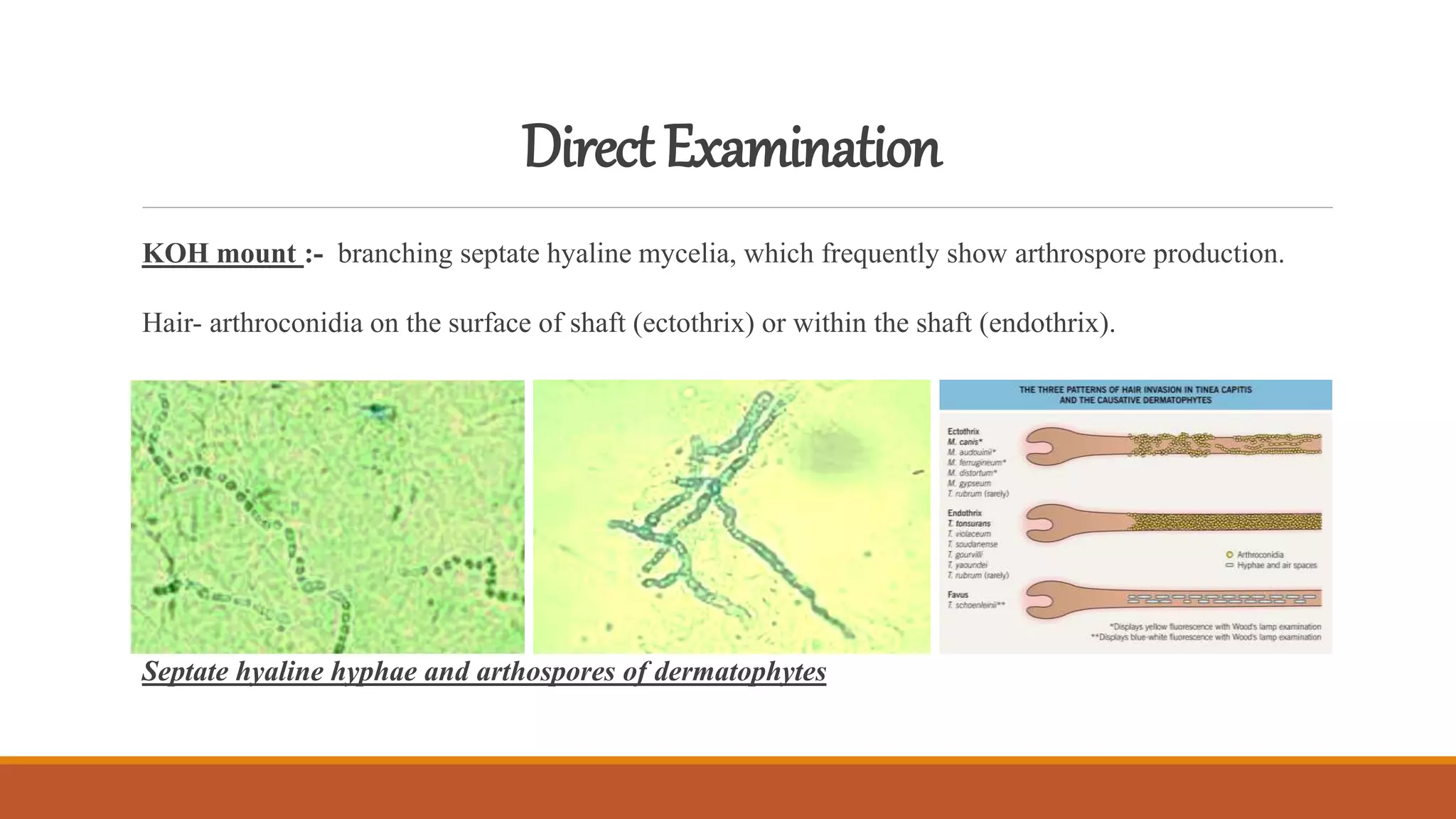 Dermatophytes | PPTX