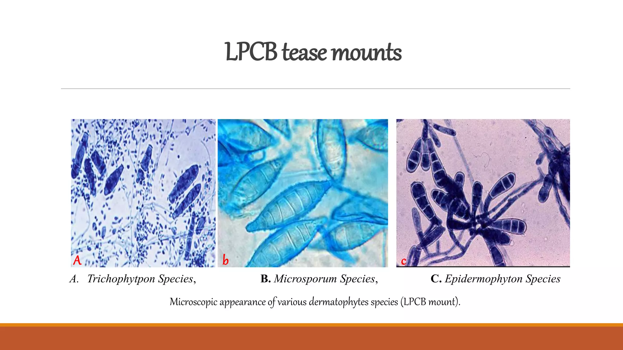 Dermatophytes | PPTX