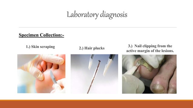 Dermatophytes | PPTX | Skin and Dermatology | Diseases and Conditions