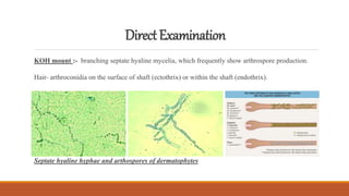 Dermatophytes | PPTX