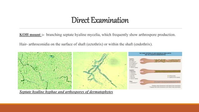 Dermatophytes | PPTX | Skin and Dermatology | Diseases and Conditions