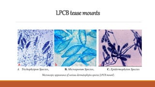 Dermatophytes | PPTX